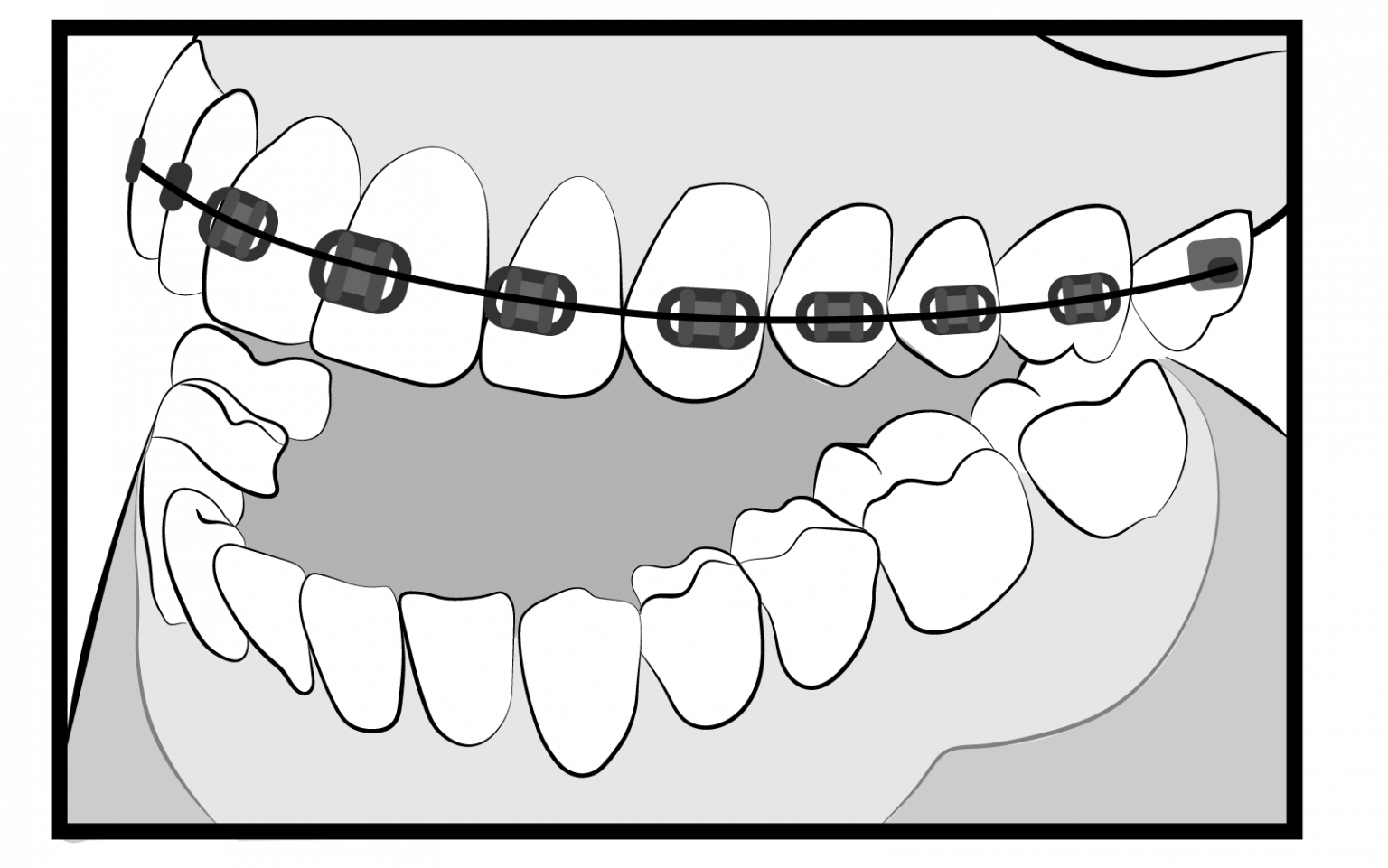 Orthodontic Treatment Plan Archives - Cooney & Tyner Orthodontics